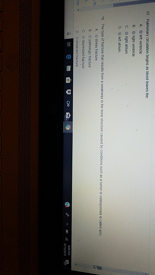 Solved EC demauts may be caused by A OViral infections or a | Chegg.com