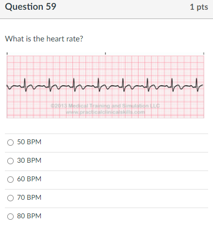 Question 58 What is the heart rate? سلسل السله O 30 | Chegg.com