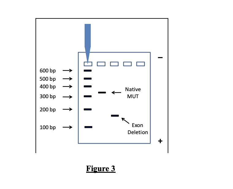 Order of samples on Gel L= ladder K= native gene U= | Chegg.com