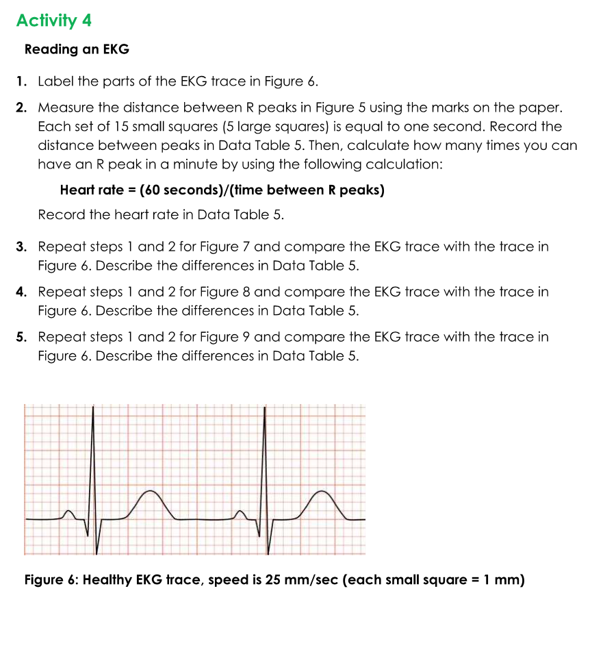 Activity 4 Reading an EKG 1. Label the parts of the | Chegg.com