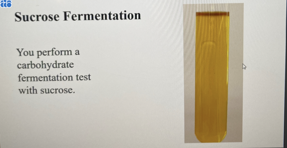 Solved Sucrose Fermentation You perform a carbohydrate | Chegg.com
