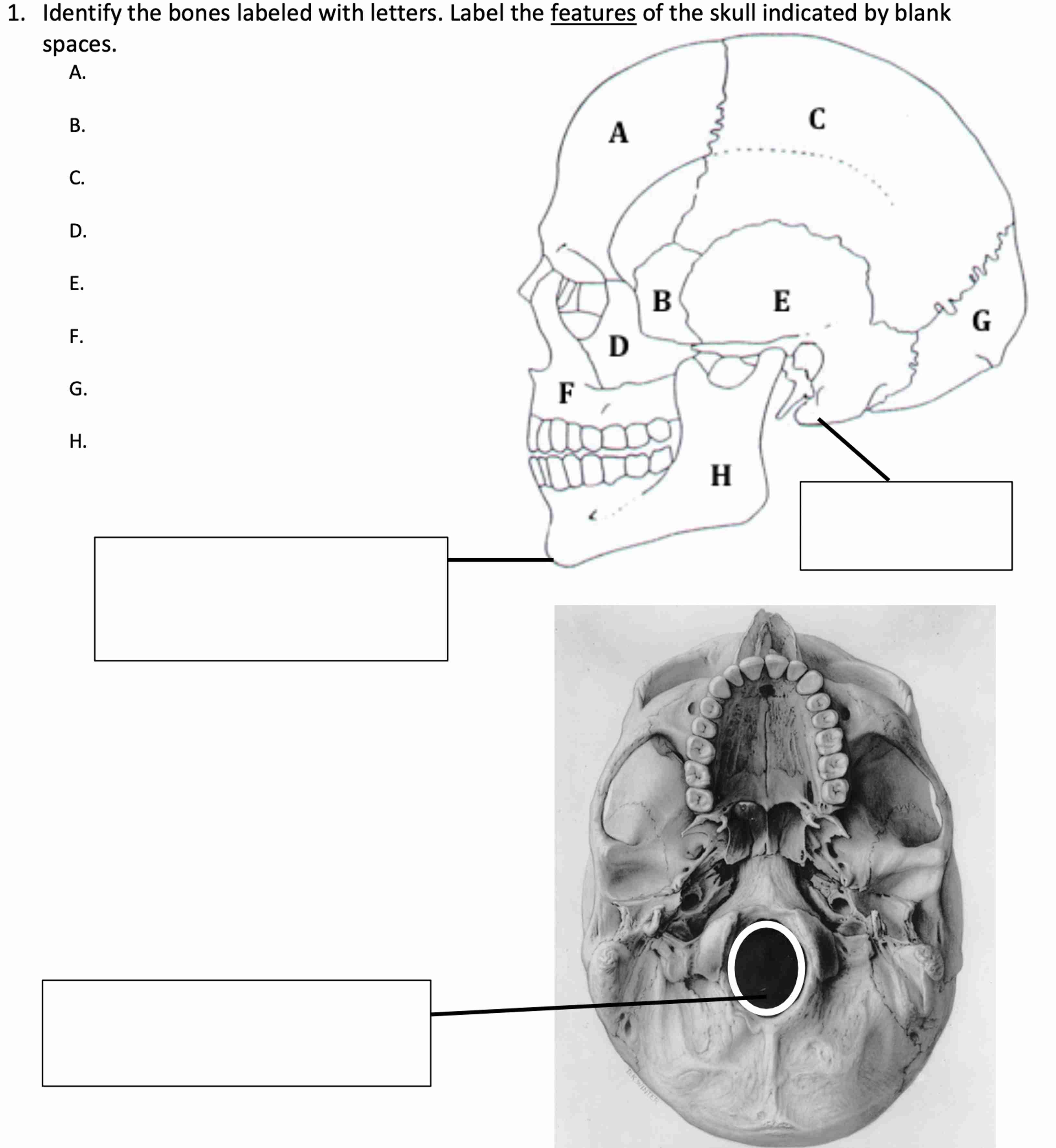 Solved Identify the bones labeled with letters. Label the | Chegg.com