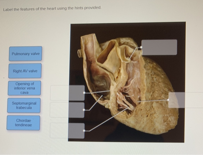 Solved Label The Structures Of The Heart Using The Hints Chegg