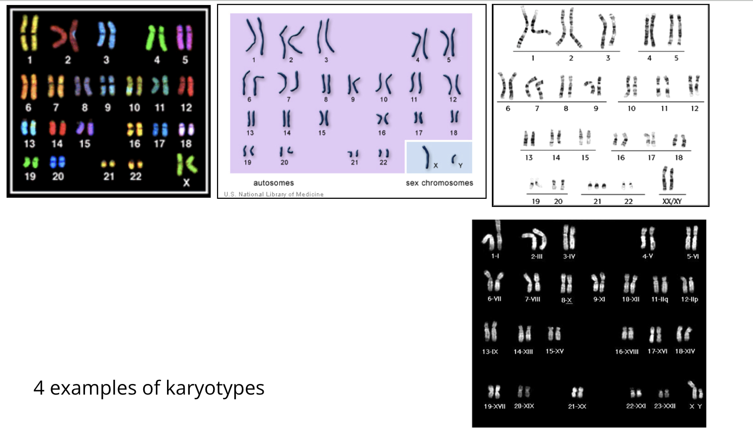 Solved Sometimes genetic errors occur with chromosomes, too. | Chegg.com