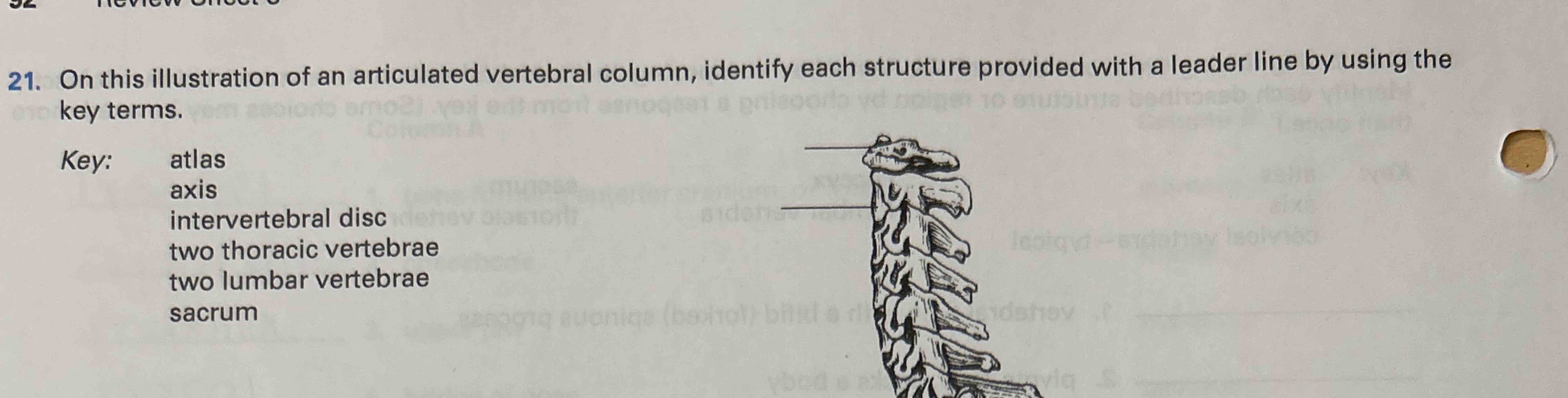 Solved On this illustration of an articulated vertebral | Chegg.com