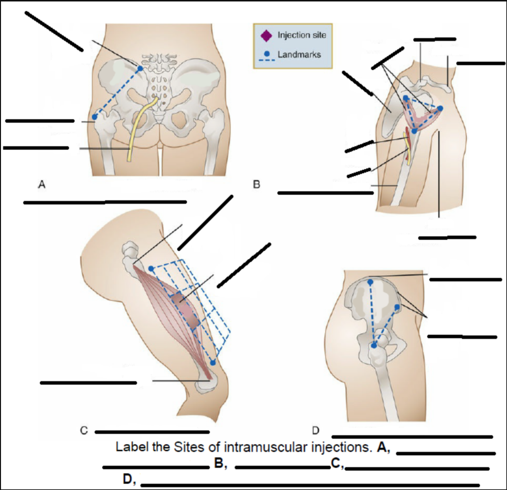 Solved Label each intramuscular injection site and identify | Chegg.com
