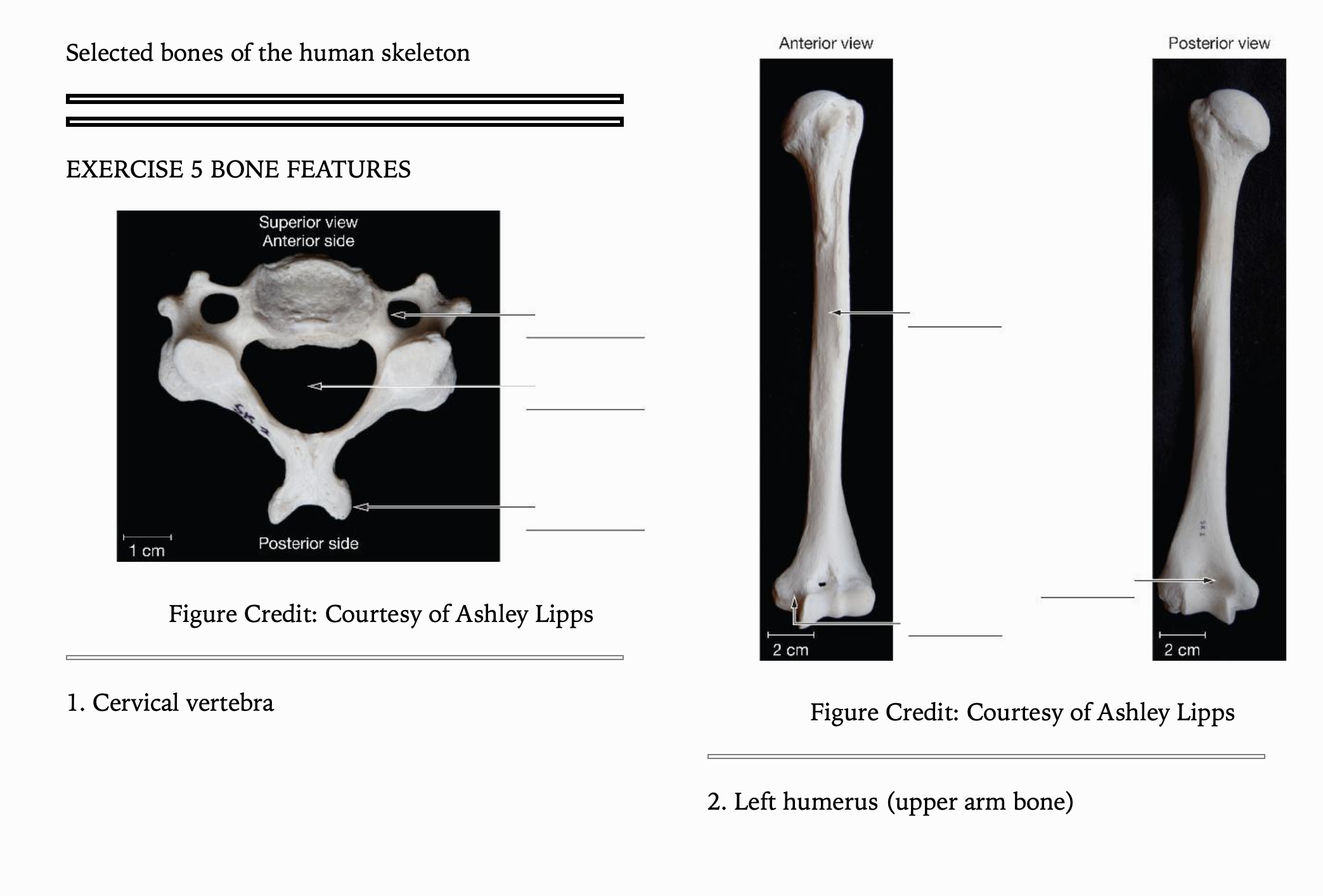 Examine the hip bone (pelvis) depicted in Part C of | Chegg.com