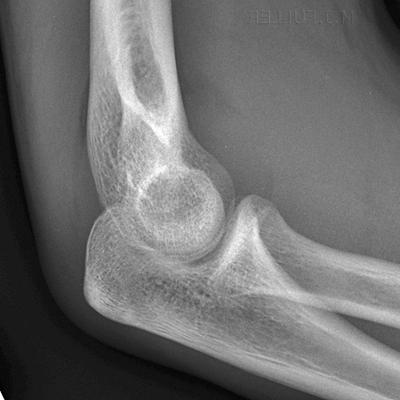 Solved upper extremity radiography Please ensure that you | Chegg.com