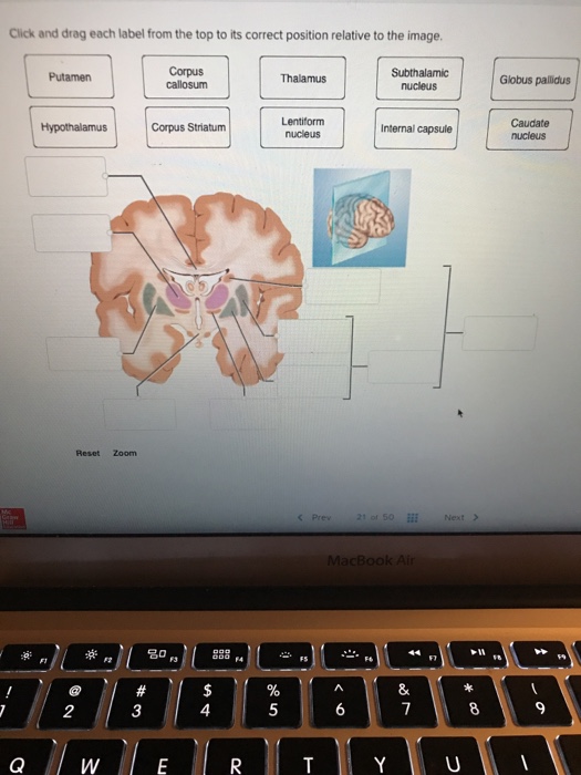 Solved Click and drag each label from the top to its correct | Chegg.com