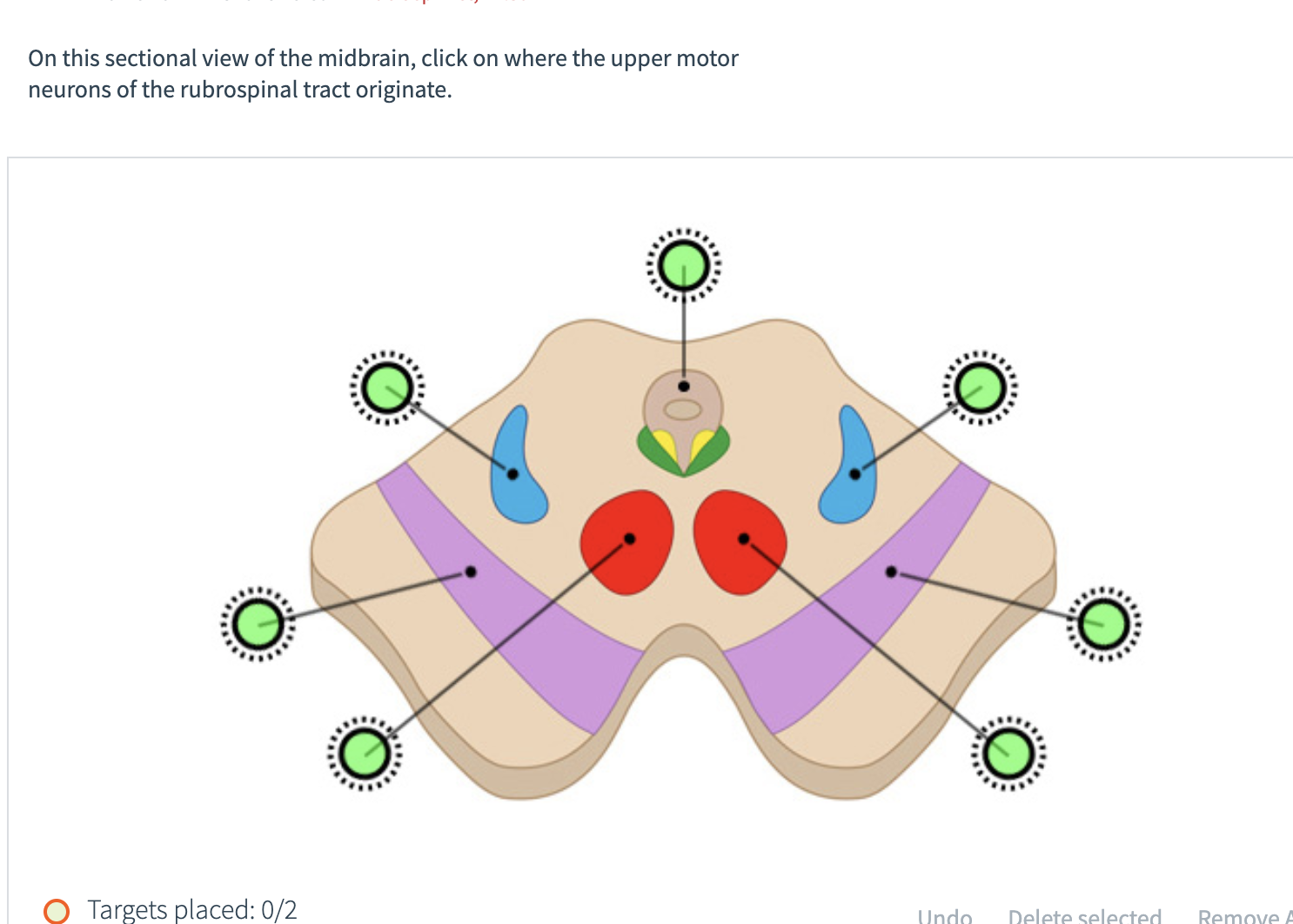 Solved On This Sectional View Of The Midbrain Click On