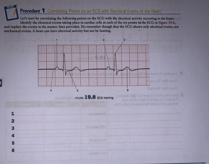 Solved Procedure 1 Correlating Points On An Ecg With