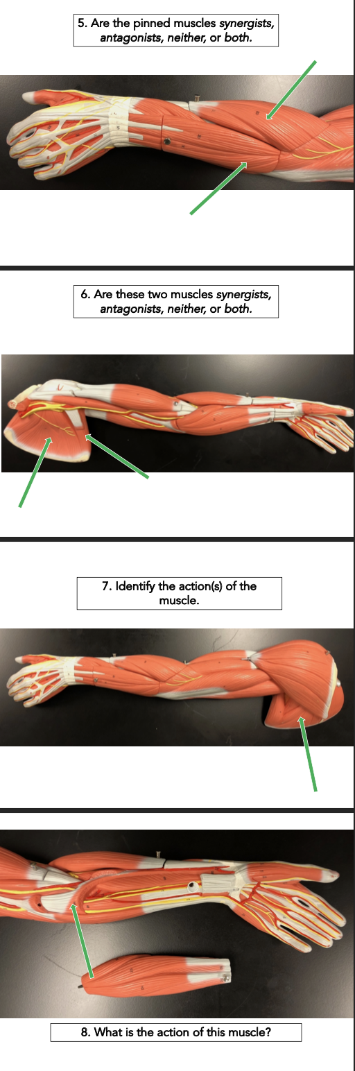 Solved 5. Are the pinned muscles synergists, antagonists, | Chegg.com