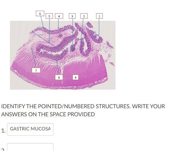 Solved 6 5 3 2 7 8 9 IDENTIFY THE POINTED/NUMBERED | Chegg.com