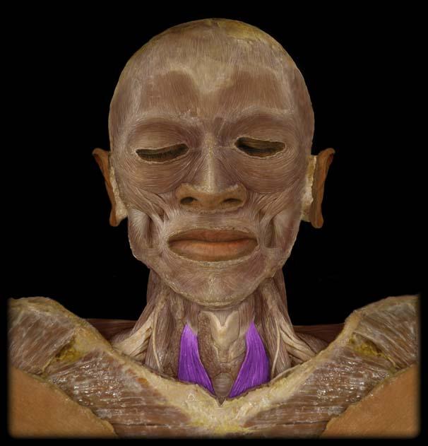 Sternohyoid Cadaver