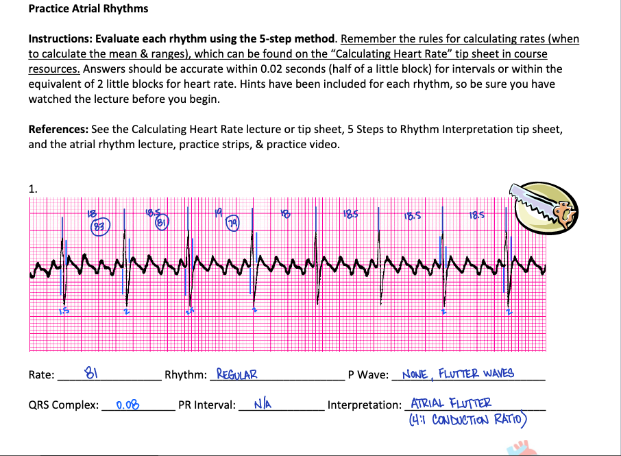 Solved Rate: Rhythm: P Wave: QRS Complex: PR Interval: | Chegg.com