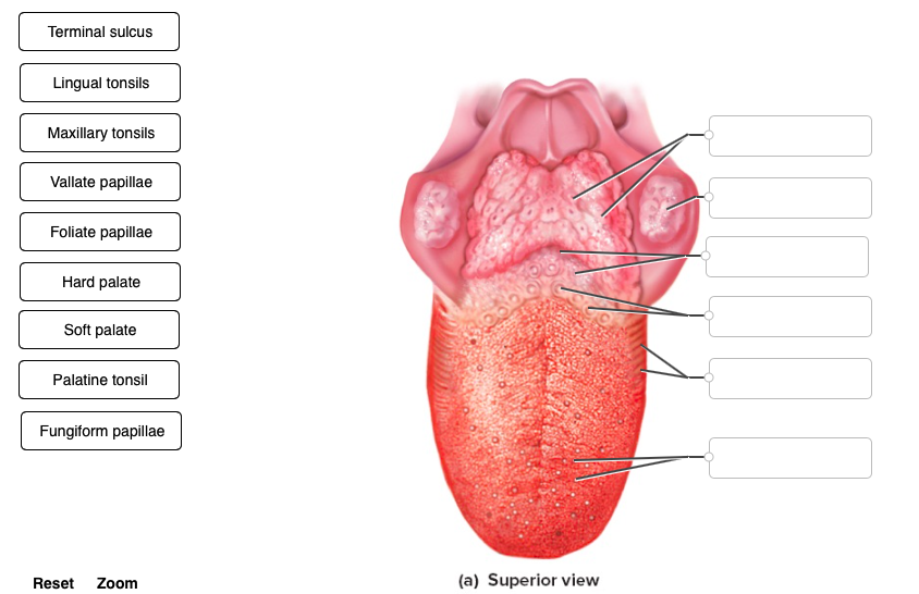Solved Terminal sulcus Lingual tonsils Maxillary tonsils | Chegg.com