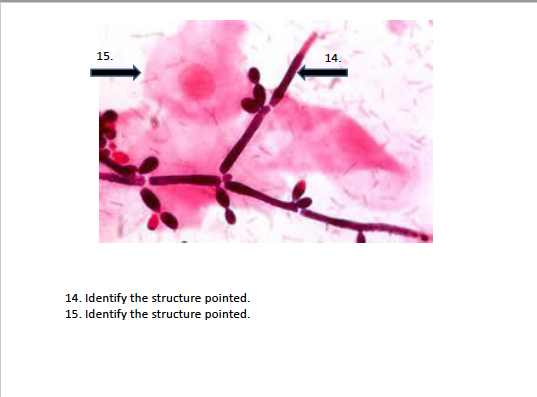 Solved 15. 14. 14. Identify the structure pointed. 15. | Chegg.com