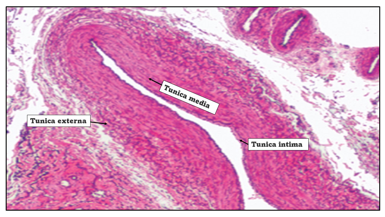Solved Tunica externa Tunica media Tunica intima | Chegg.com