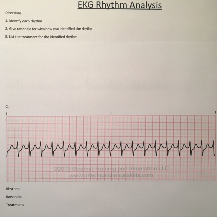 Solved EKG Rhythm Analysis 1. Identify each rhythmm 2. Give | Chegg.com