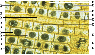 Solved Count the number of cells in each phase (Interphase, | Chegg.com