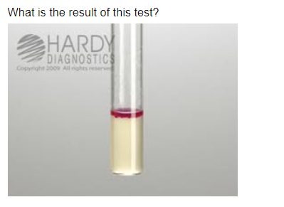 Solved What is the result of this test? a) negative for | Chegg.com