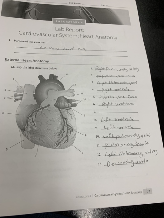 Solved Key Terms Matching mediastinum A. pumps blood into | Chegg.com