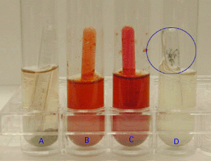 Solved Interpret the nitrate results seen below. Tube A | Chegg.com