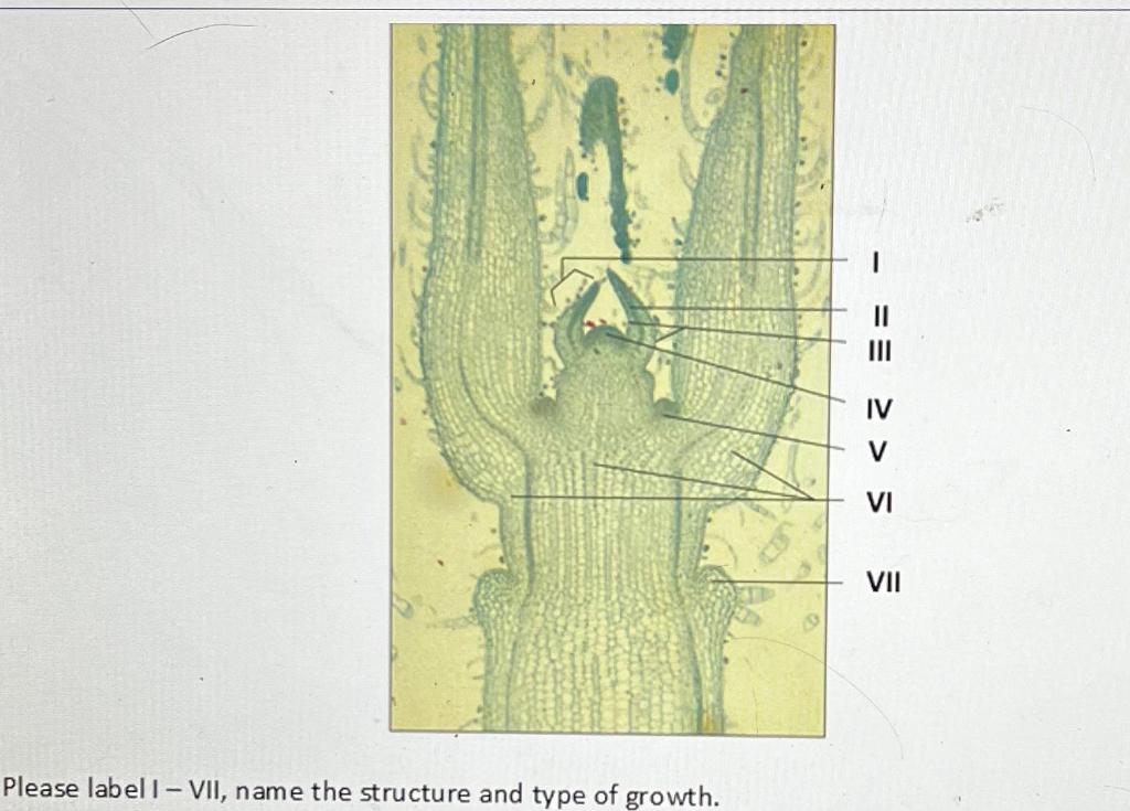 Solved Please labell - VII, name the structure and type of | Chegg.com