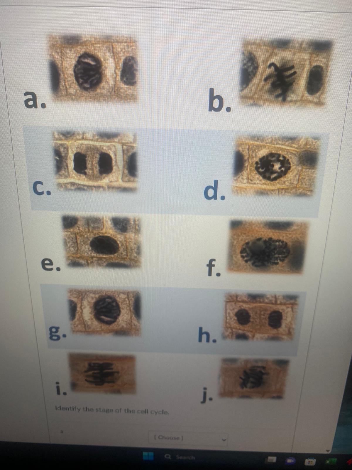 Solved Identify the stage of the cell cycle. | Chegg.com