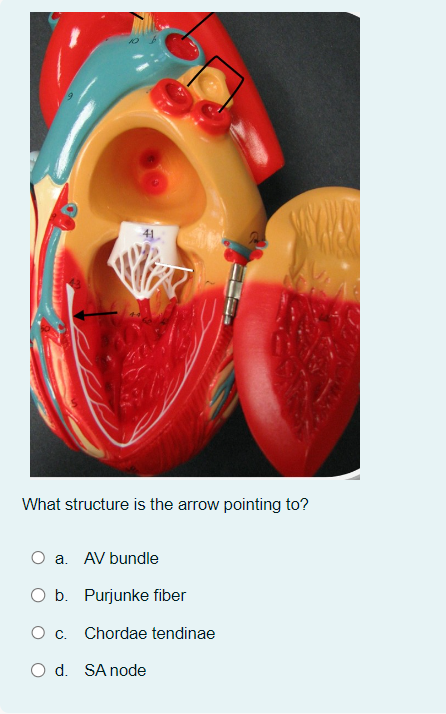 What vessel is the arrow pointing to? a. Superior | Chegg.com
