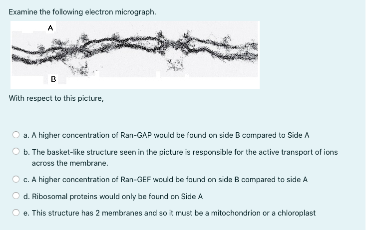 Solved Examine the following electron micrograph. A B With | Chegg.com