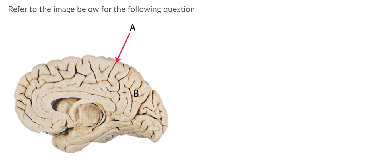 Solved Refer to the image below for the following question A | Chegg.com