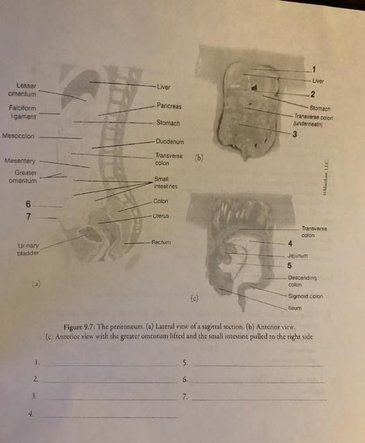Solved Liver Liver 2 Lesser omentum Falciform igament | Chegg.com
