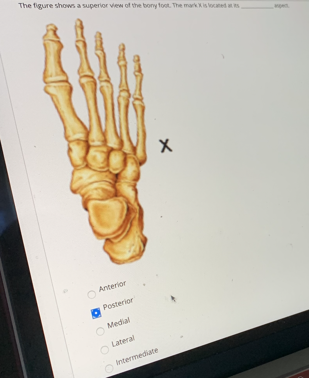 Solved The figure shows a superior view of the bony foot. | Chegg.com