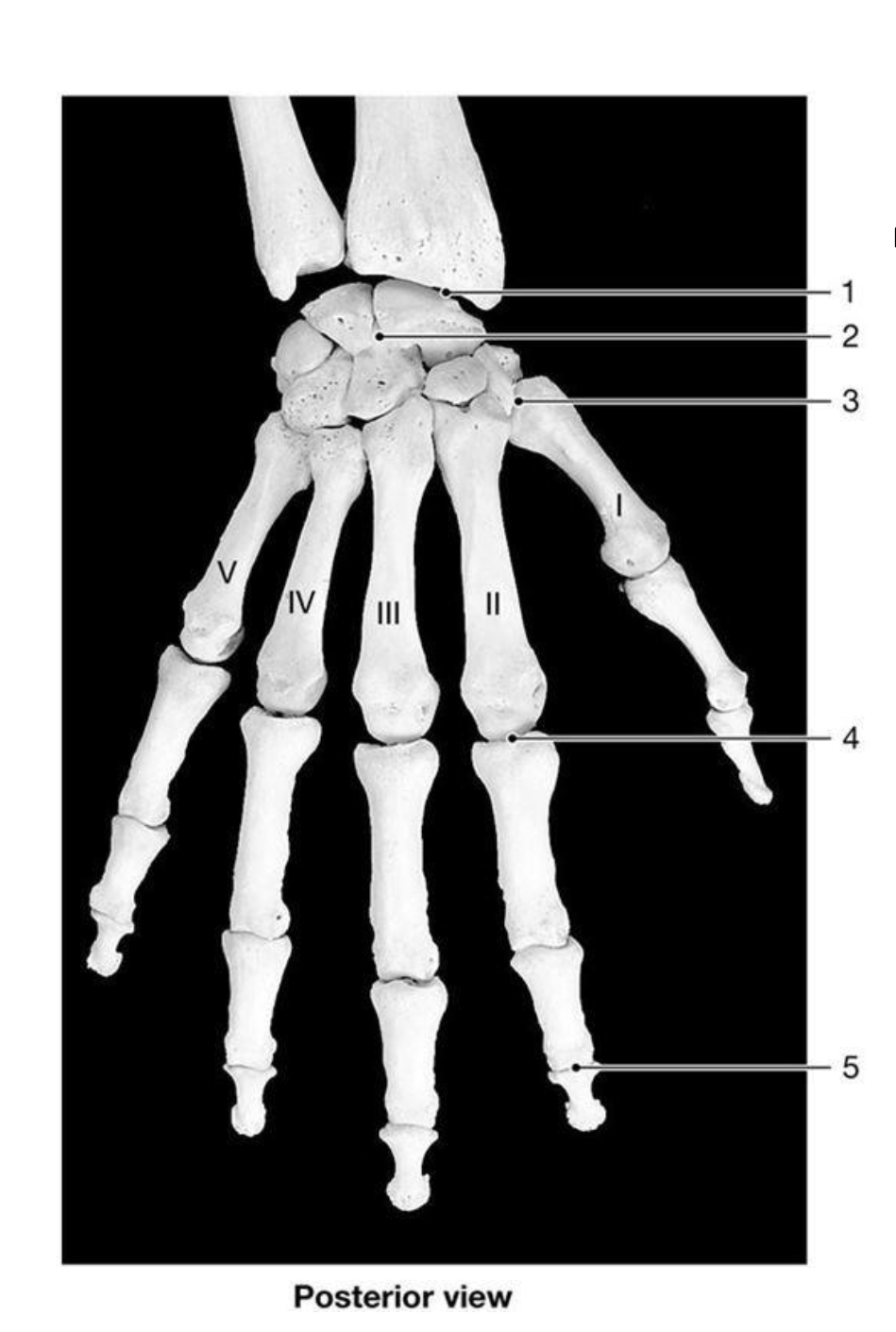 Solved Posterior view | Chegg.com