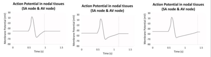 Solved Action Potential in nodal tissues (SA node & AV node) | Chegg.com