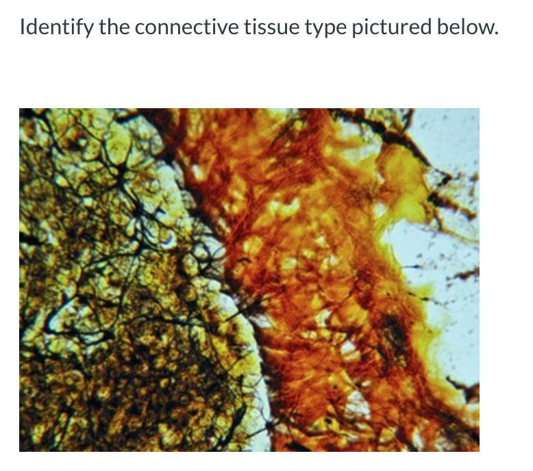 Solved Identify the epithelial tissue type pictured below. 及 | Chegg.com Solved Identify the epithelial tissue type pictured below. 及 | Chegg.com