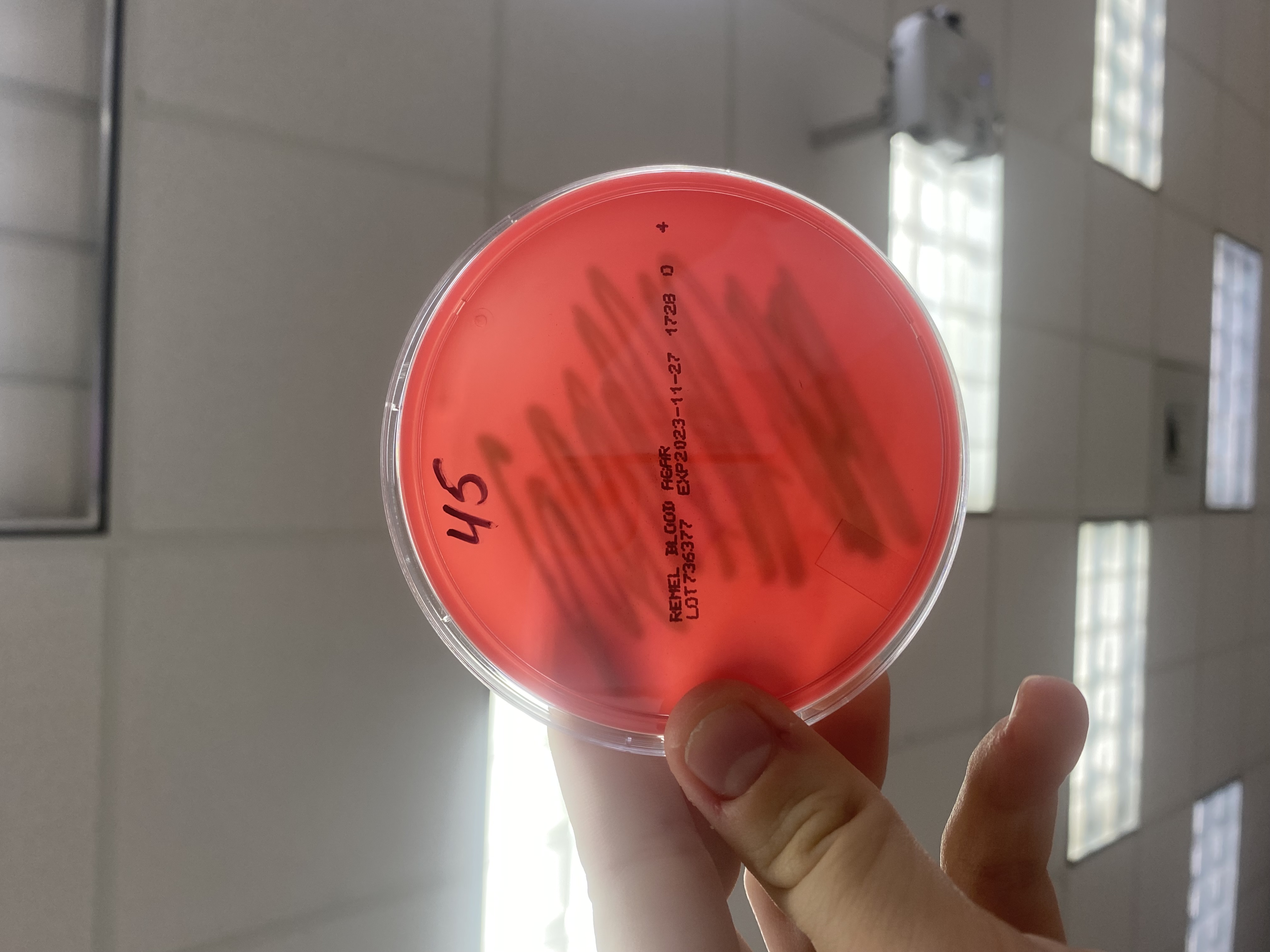 Solved What kind of hemolysis is this of Salmonella | Chegg.com