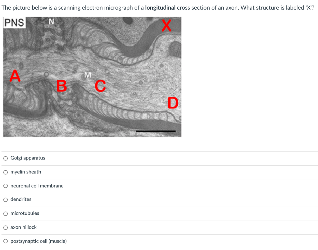 Solved The picture below is a scanning electron micrograph | Chegg.com
