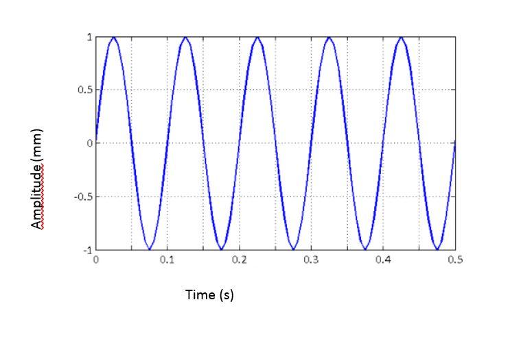 Solved The figure shows the vibratory response of a | Chegg.com