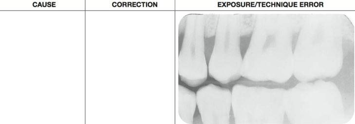 Solved CAUSE CORRECTION EXPOSURE/TECHNIQUE ERROR | Chegg.com