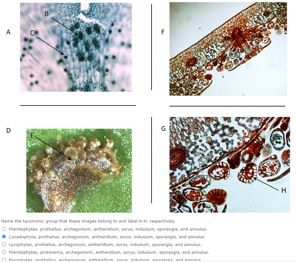 Solved 11 III 1 2 3 Н. A F B D Please label I-III, 1-3, and | Chegg.com