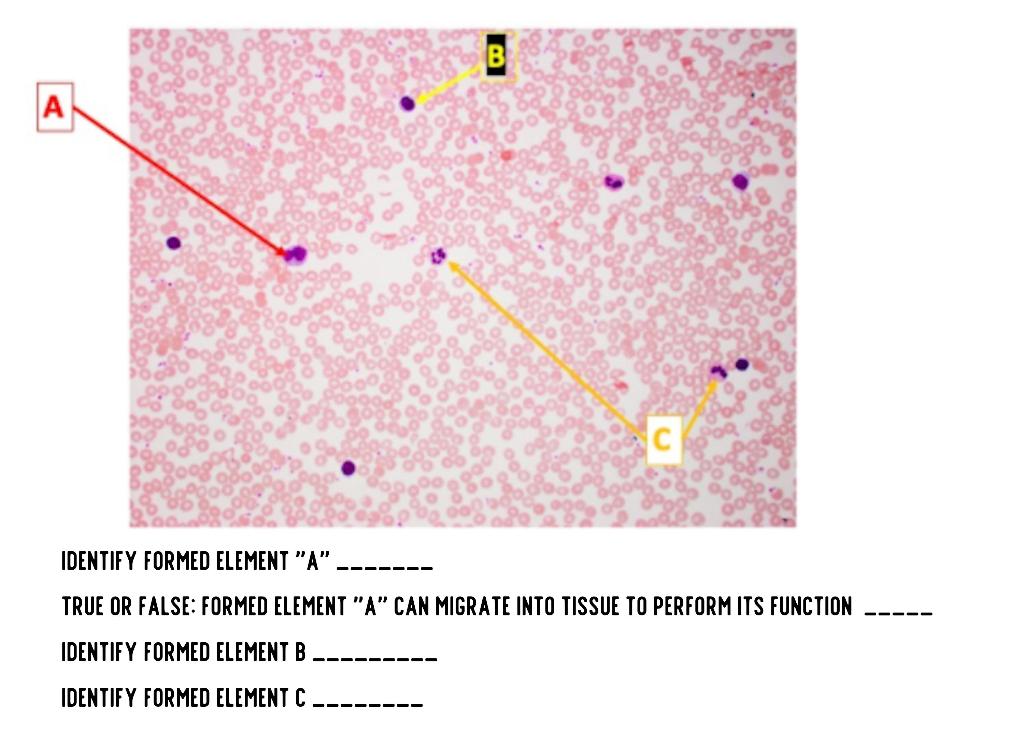 Solved A IDENTIFY FORMED ELEMENT "A" TRUE OR FALSE: FORMED | Chegg.com