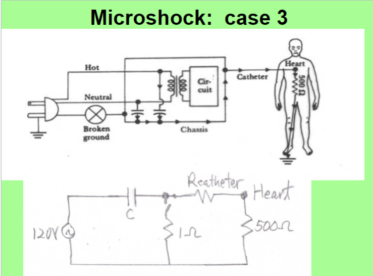 A patient received a microshock when using an | Chegg.com
