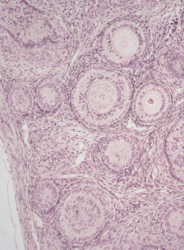 Solved Where is the primary unilaminar follicle, primary | Chegg.com