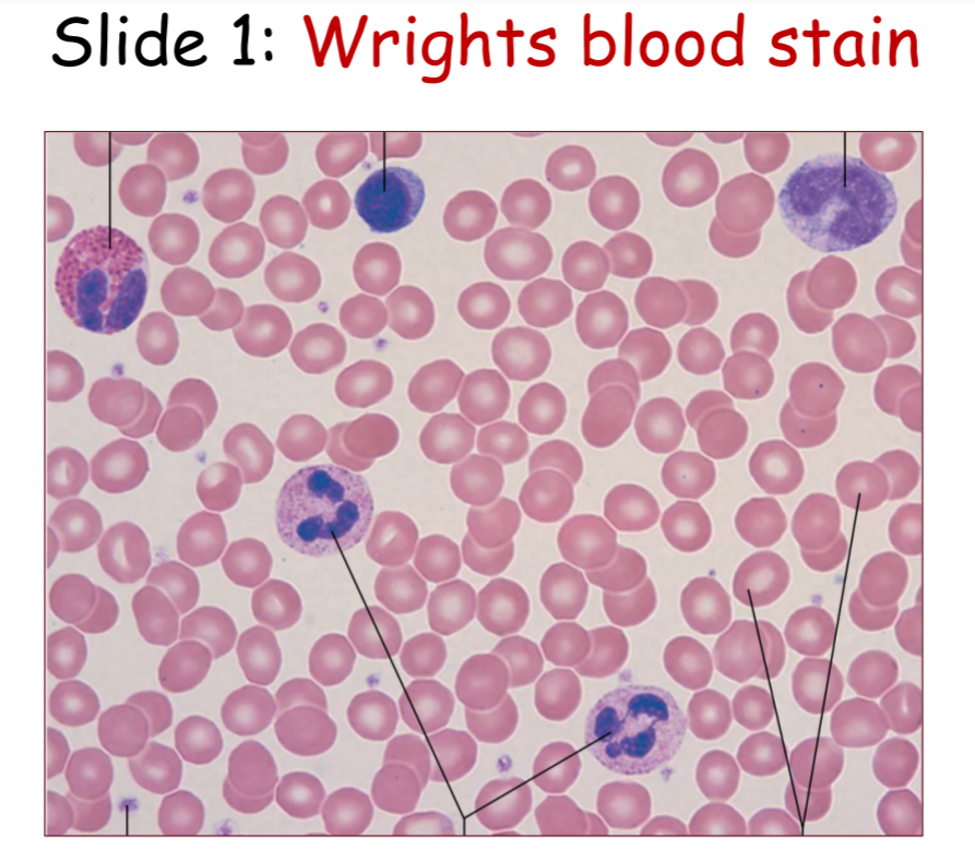 Solved Sketch and Label : Blood HP Wright’s stain | Chegg.com
