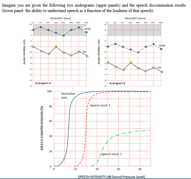 Solved Imagine you are given the following two audiograms | Chegg.com