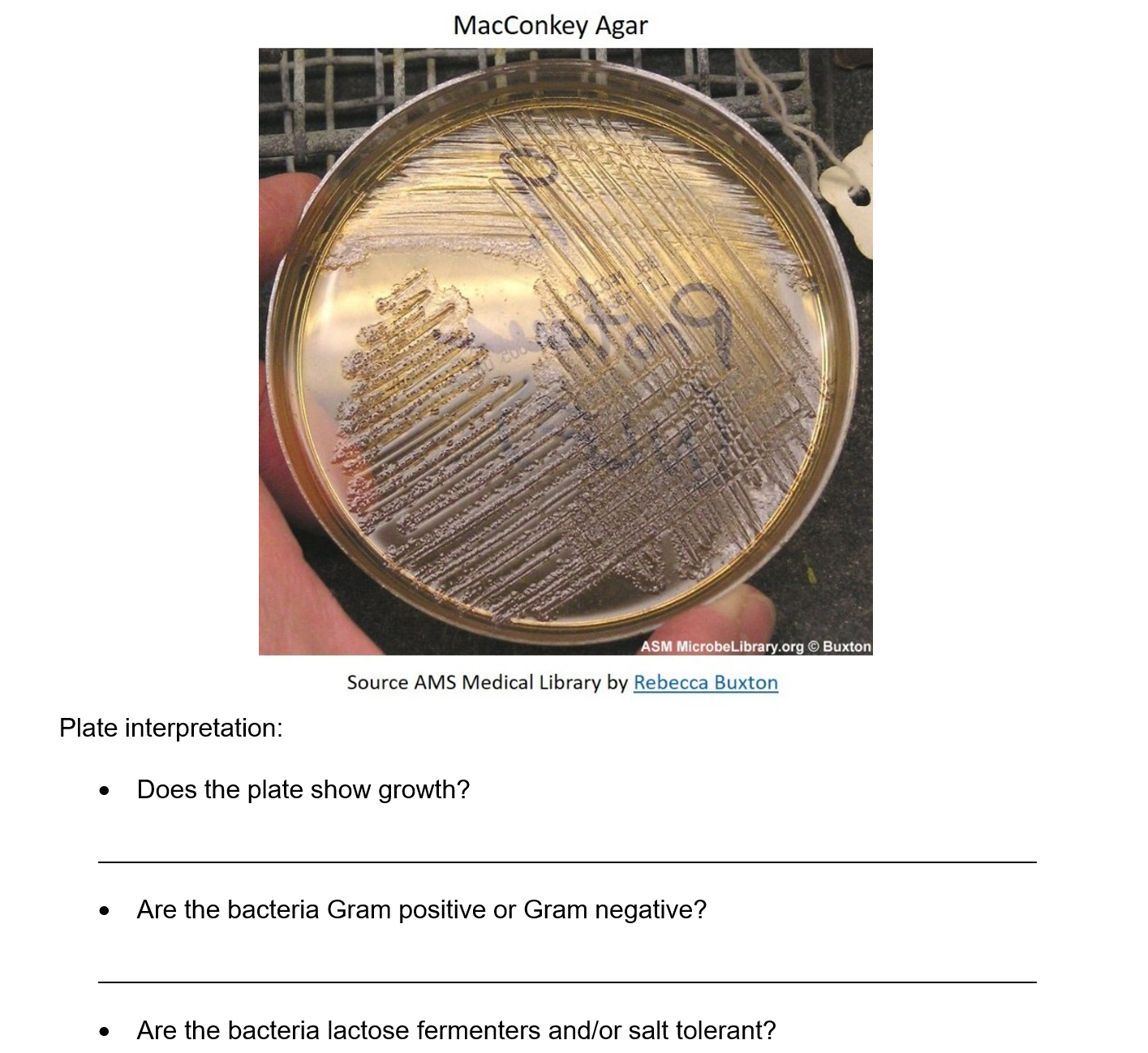 Solved Plate interpretation:• ﻿Does the plate show growth?• | Chegg.com