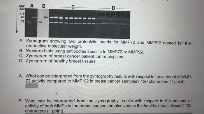 Solved A. Zymogram showing two proteolytic bands for MMP72 | Chegg.com