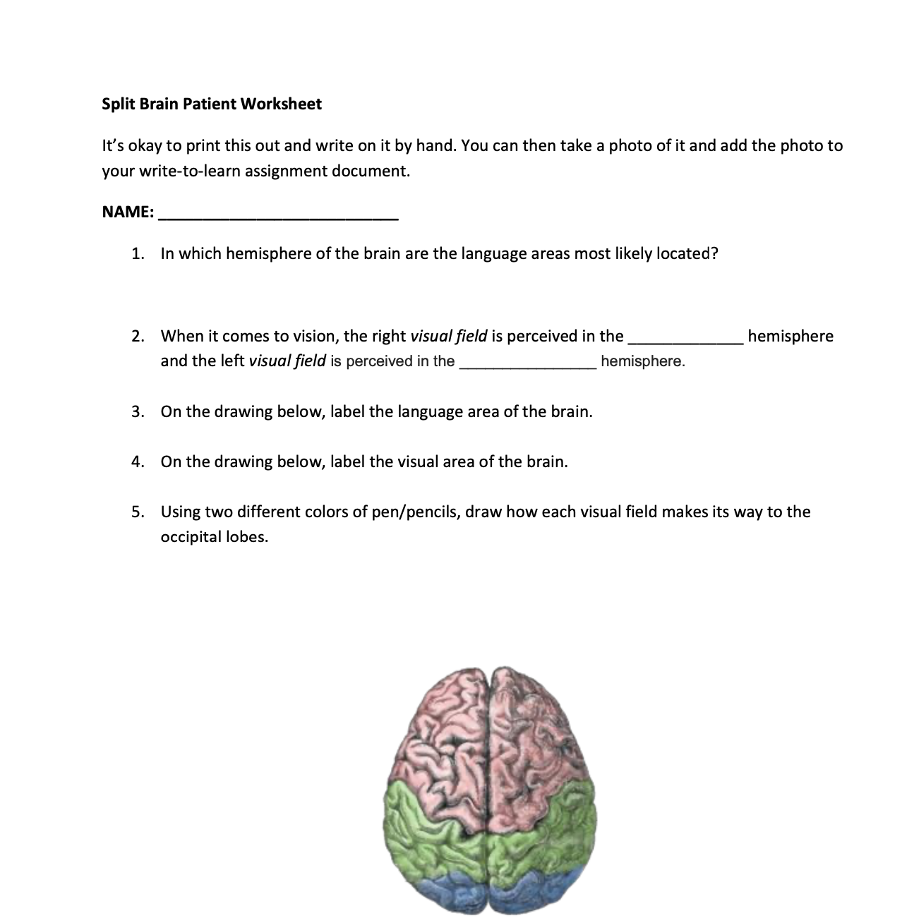 Solved Split Brain Patient Worksheet It's okay to print this | Chegg.com